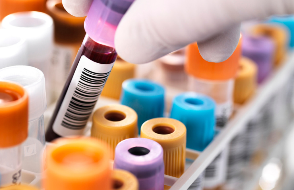Guiding personalised treatment for soft tissue sarcoma patients ...