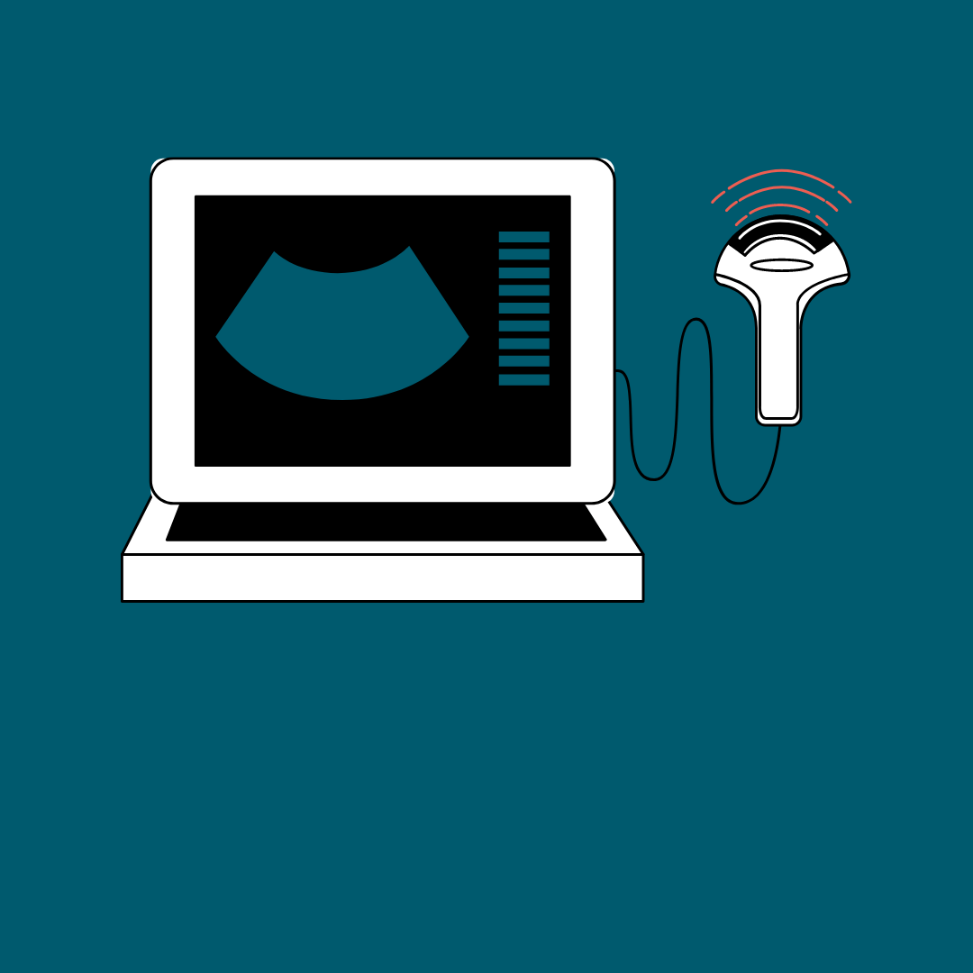 Promotion of ultrasound guidelines | Sarcoma UK
