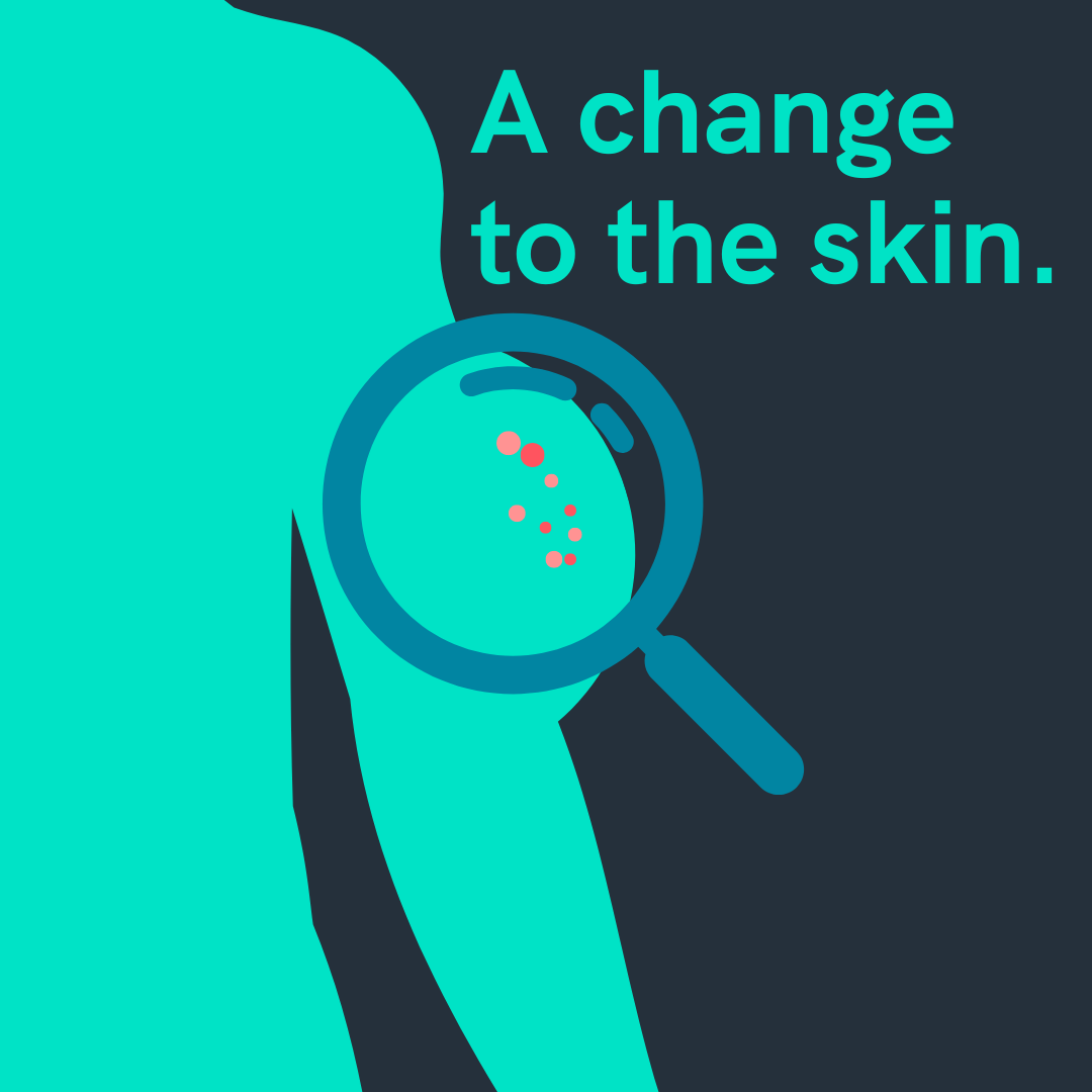 Measuring and tracking a lump | Sarcoma UK